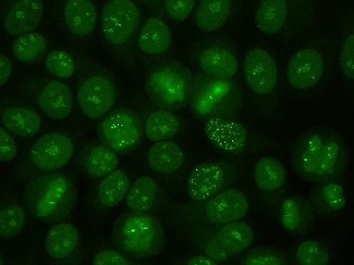 Antikörper gegen NOR-90 oder RNA Polymerase I